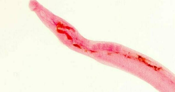 Tracking vampire worms with machine learning - using AI to diagnose ...