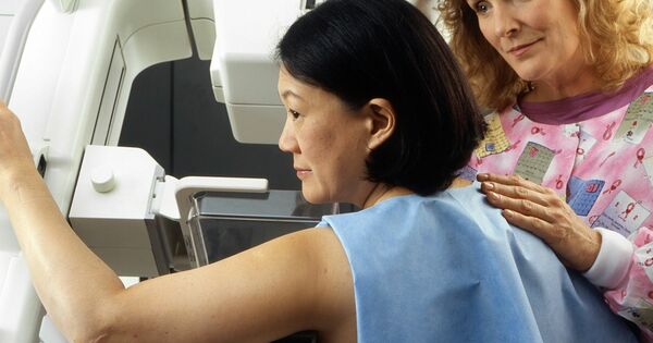 Thousands seek advice following breast cancer screening campaign