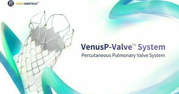 Venus Medtech VenusP-Valve transcatheter pulmonic valve replacement ...