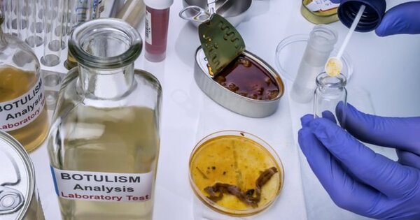 Major botulism outbreak leaves 30 Muscovites in intensive care