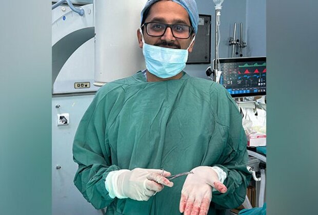 Needle extracted that travelled in veins of a woman for three years