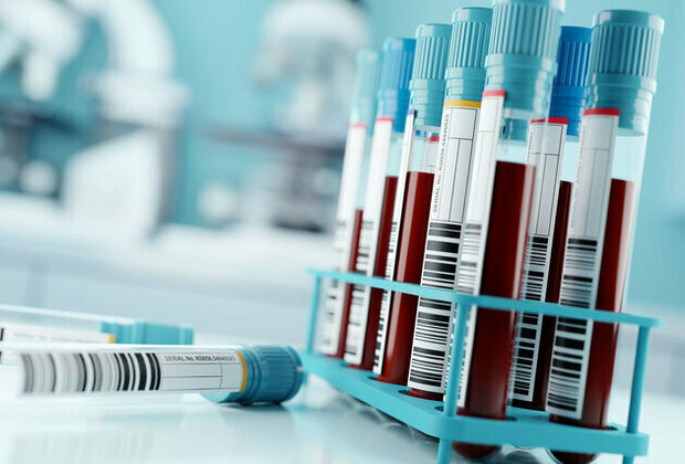 Abu Dhabi introduces non-invasive liquid biopsy test for colorectal ...