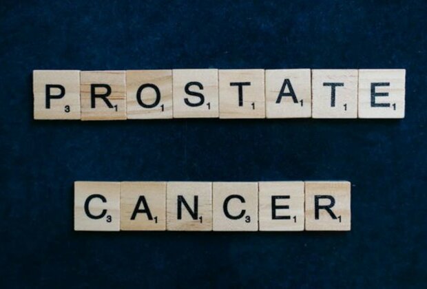 Research shows new approach to target deadly form of prostate cancer