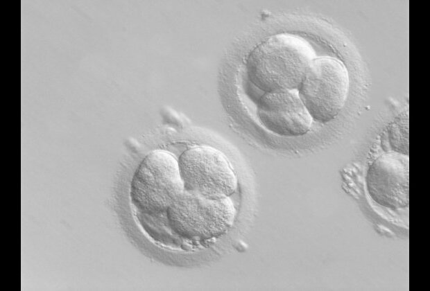AI 'Stork' can help scan IVF embryos for faster implantation