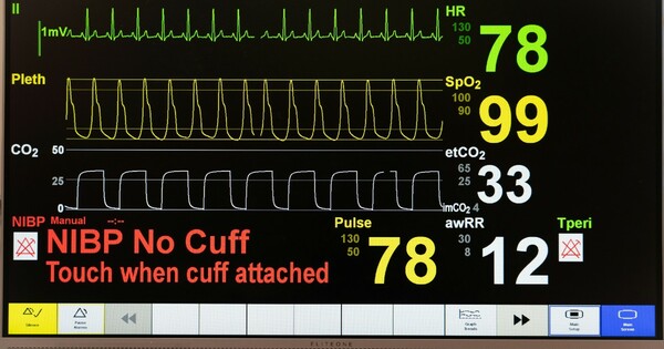 Barts Health seeks real-time continuous vital signs monitoring system