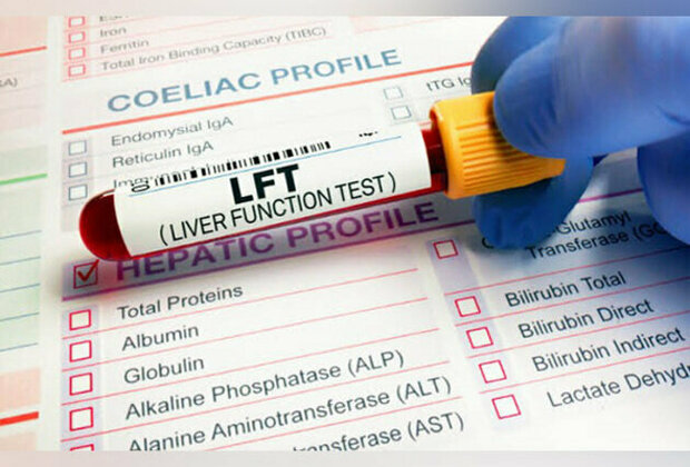 When Should You Get Liver Function Tests Done? Signs and Symptoms that ...