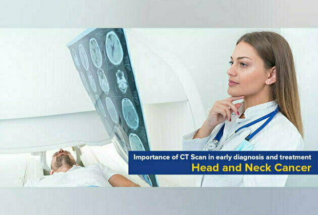 Head and Neck Cancer: Importance of CT Scan in Early Diagnosis and ...