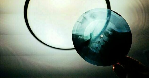 When Elvis and Ella were pressed onto X-rays - the subversive legacy of ...