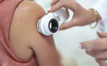 Bupa integrates AI into skin cancer checks