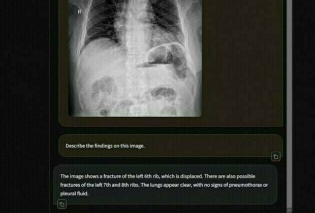 Harrison.ai launches world leading AI model to transform healthcare