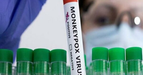 Atleast 30 children test positive for monkeypox in US: Reports