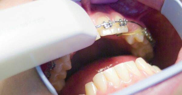 NHS launches 'golden hello' dentist scheme